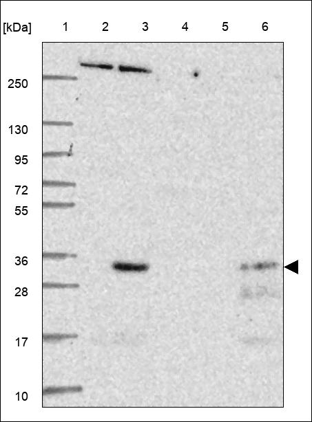 Rabbit Polyclonal Anti-RBM38 Antibody - Buy for research - Highly specific, rigorously validated ...