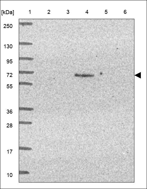 Rabbit Polyclonal Anti-PRF1 Antibody - Buy for research - Highly specific, rigorously validated ...
