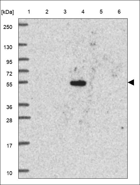 Rabbit Polyclonal Anti-RSKR Antibody - Buy for research - Highly specific, rigorously validated ...