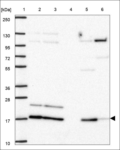 Rabbit Polyclonal Anti-RER1 Antibody - Buy for research - Highly specific, rigorously validated ...