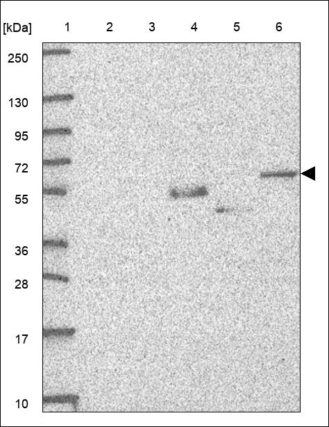 Rabbit Polyclonal Anti-ANKH Antibody - Buy for research - Highly specific, rigorously validated ...