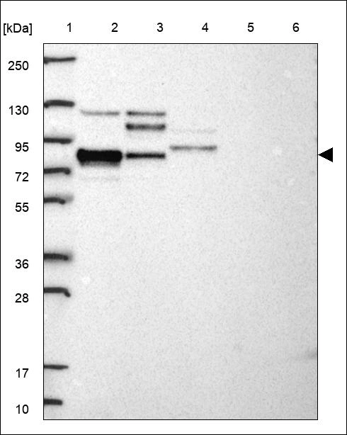 Anti-MID1 Human Protein Atlas Antibody