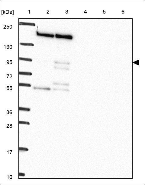 Anti-MAP1S Human Protein Atlas Antibody
