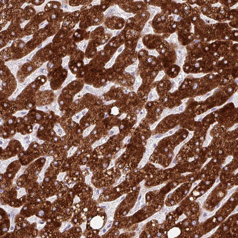 Mouse Monoclonal Anti-SLC27A5 Antibody - Buy for research - Highly ...