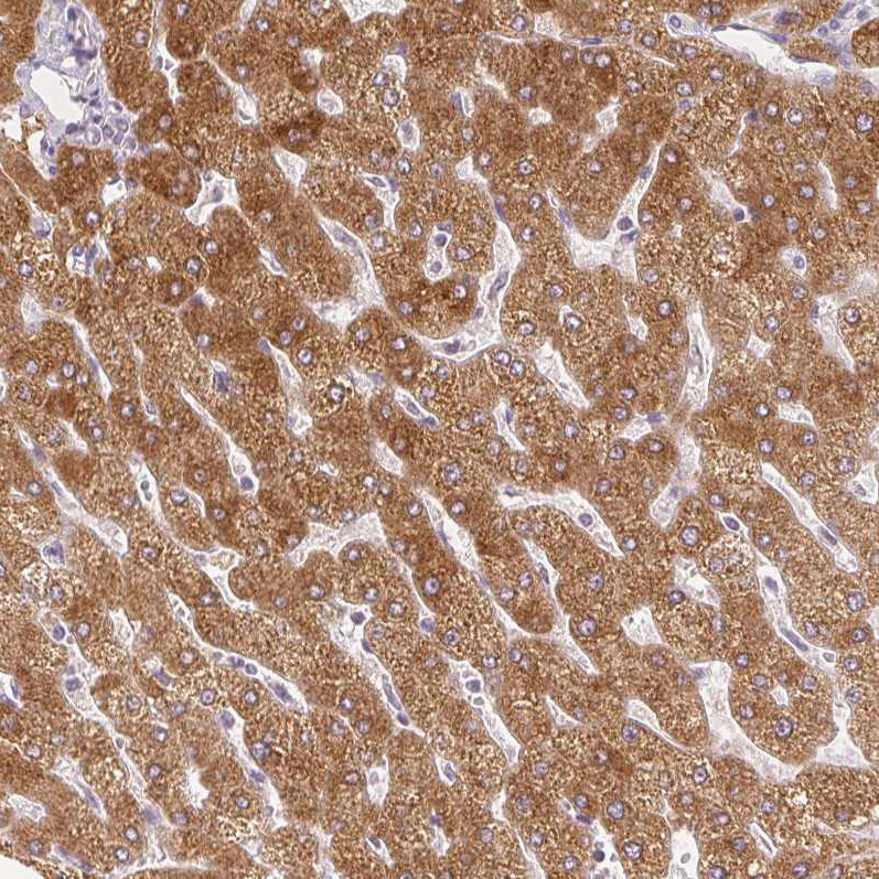 Mouse Monoclonal Anti-SLC27A5 Antibody - Buy for research - Highly ...