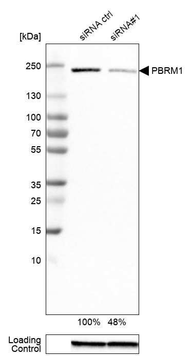 Mouse Monoclonal Anti-PBRM1 Antibody - Buy for research - Highly ...