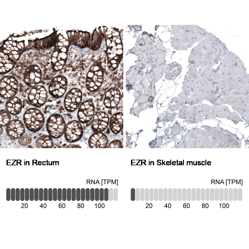 Mouse Monoclonal Anti-EZR Antibody - Buy for research - Highly specific ...