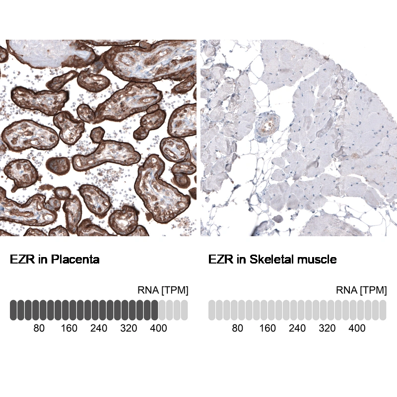Mouse Monoclonal Anti-EZR Antibody - Buy for research - Highly specific ...