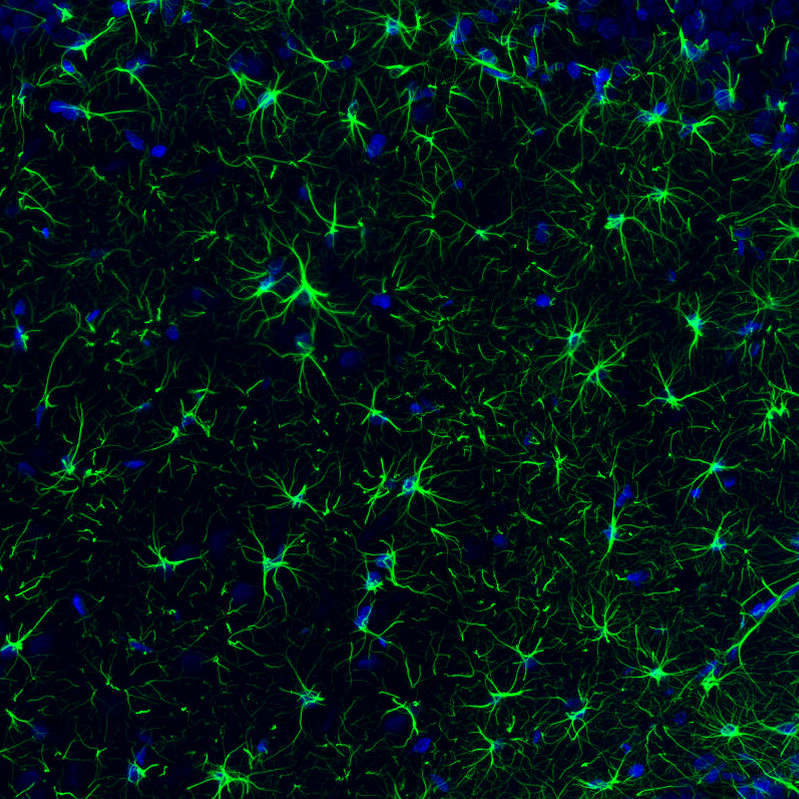 Mouse Monoclonal Anti-GFAP Antibody - Buy for research - Highly ...