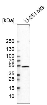 Mouse Monoclonal Anti-GFAP Antibody - Buy for research - Highly ...