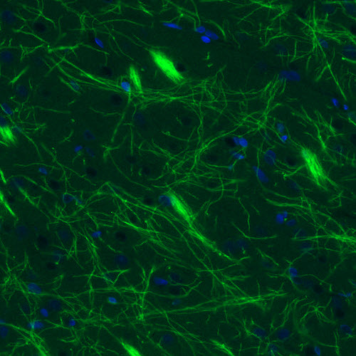 Mouse Monoclonal Anti-MBP Antibody - Buy for research - Highly specific ...