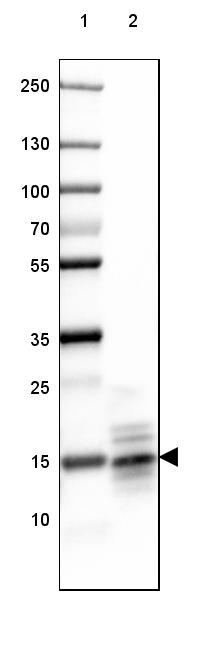 Mouse Monoclonal Anti-MBP Antibody - Buy for research - Highly specific ...
