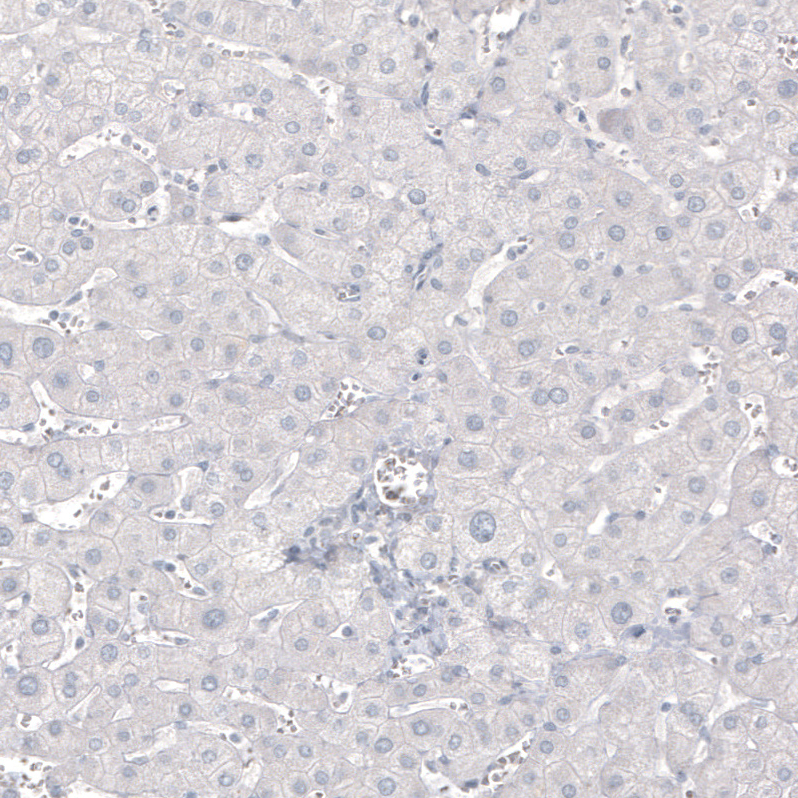 Mouse Monoclonal Anti-MBP Antibody - Buy for research - Highly specific ...