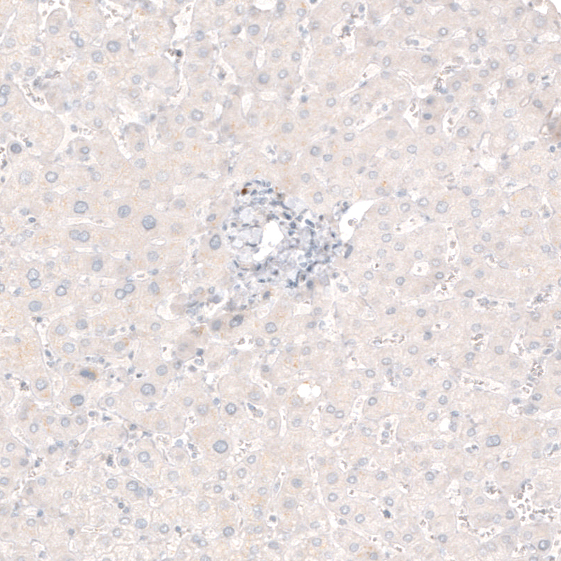 Mouse Monoclonal Anti-CHAT Antibody - Buy for research - Highly ...