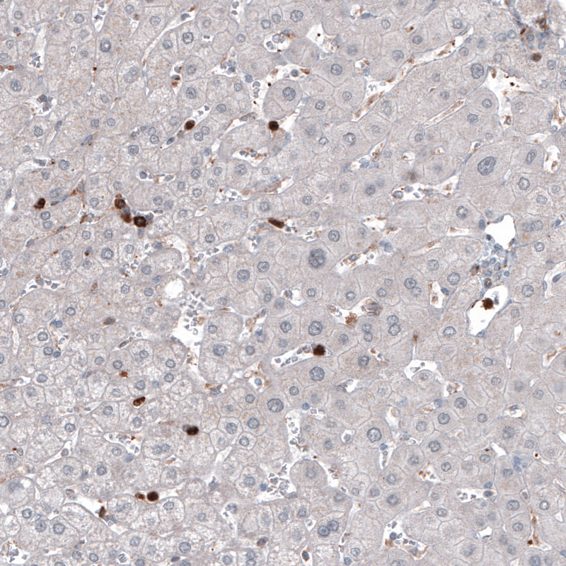 Mouse Monoclonal Anti-VSIR Antibody - Buy for research - Highly ...