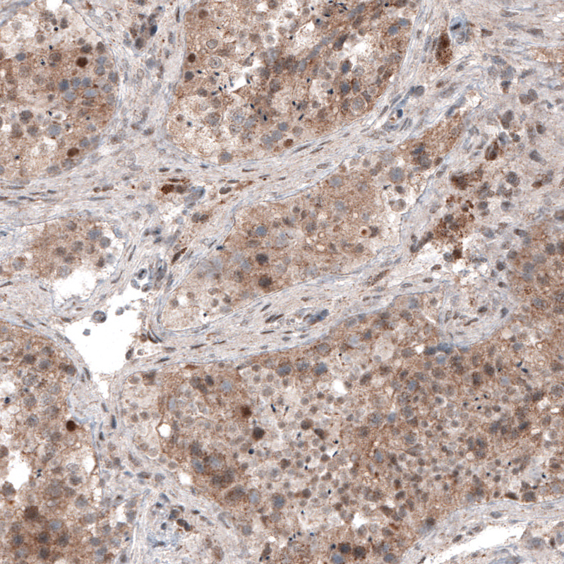 Mouse Monoclonal Anti-USP30 Antibody - Buy for research - Highly ...