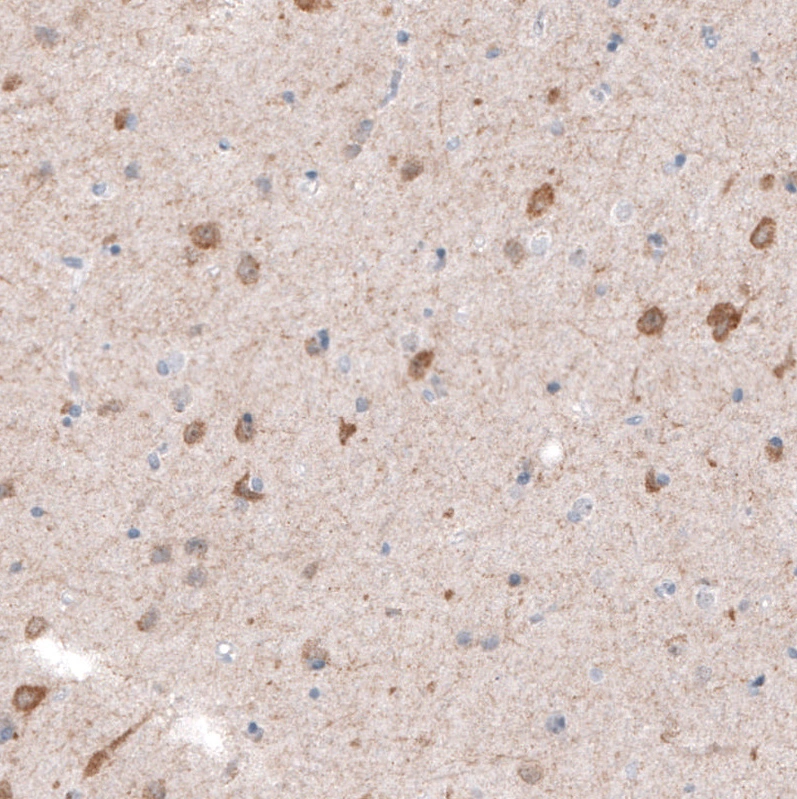 Mouse Monoclonal Anti-CDKL5 Antibody - Buy for research - Highly ...