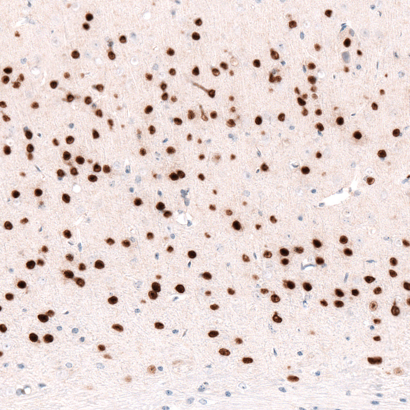 Mouse Monoclonal Anti-FOXP2 Antibody - Buy for research - Highly ...