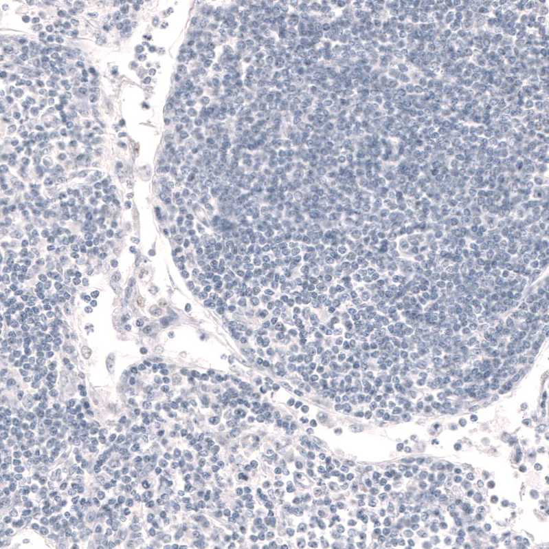 Mouse Monoclonal Anti-FOXP2 Antibody - Buy for research - Highly ...