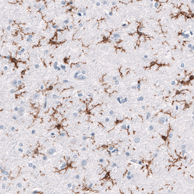 Mouse Monoclonal Anti-TMEM119 Antibody - Buy for research - Highly ...