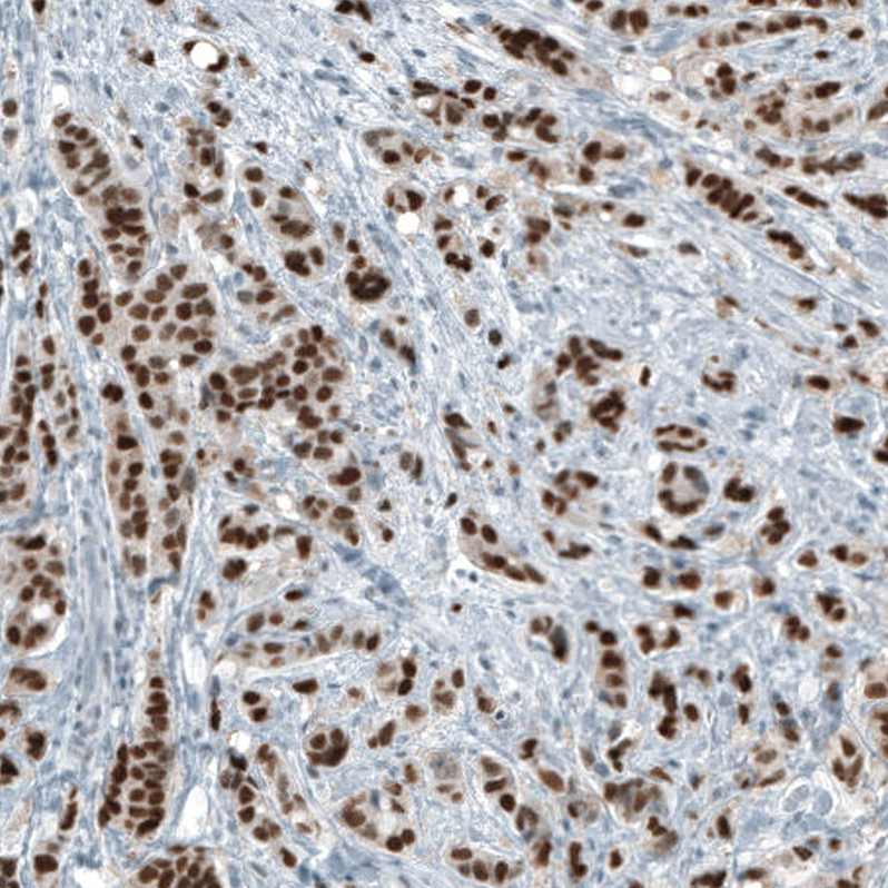 Mouse Monoclonal Anti-AR Antibody - Buy for research - Highly specific ...
