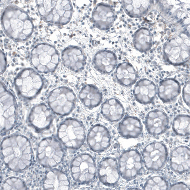 Mouse Monoclonal Anti-FRMD5 Antibody - Buy for research - Highly ...