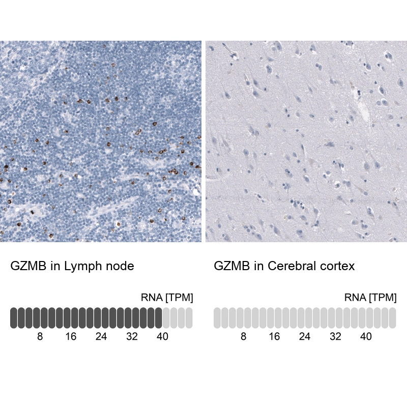 Mouse Monoclonal Anti-GZMB Antibody - Buy for research - Highly ...