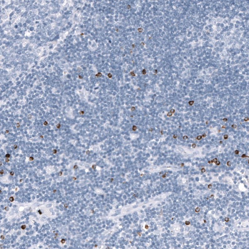 Mouse Monoclonal Anti-GZMB Antibody - Buy for research - Highly ...