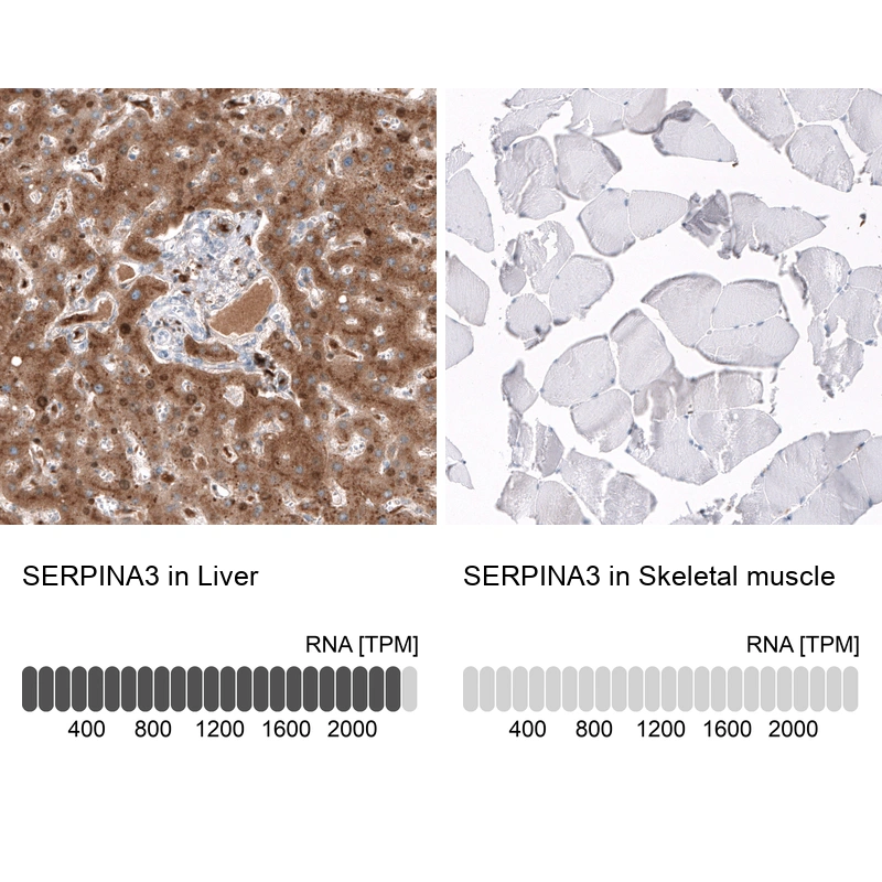 Mouse Monoclonal Anti-SERPINA3 Antibody - Buy for research - Highly ...