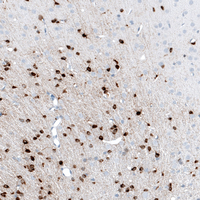 Mouse Monoclonal Anti-CRYAB Antibody - Buy for research - Highly ...