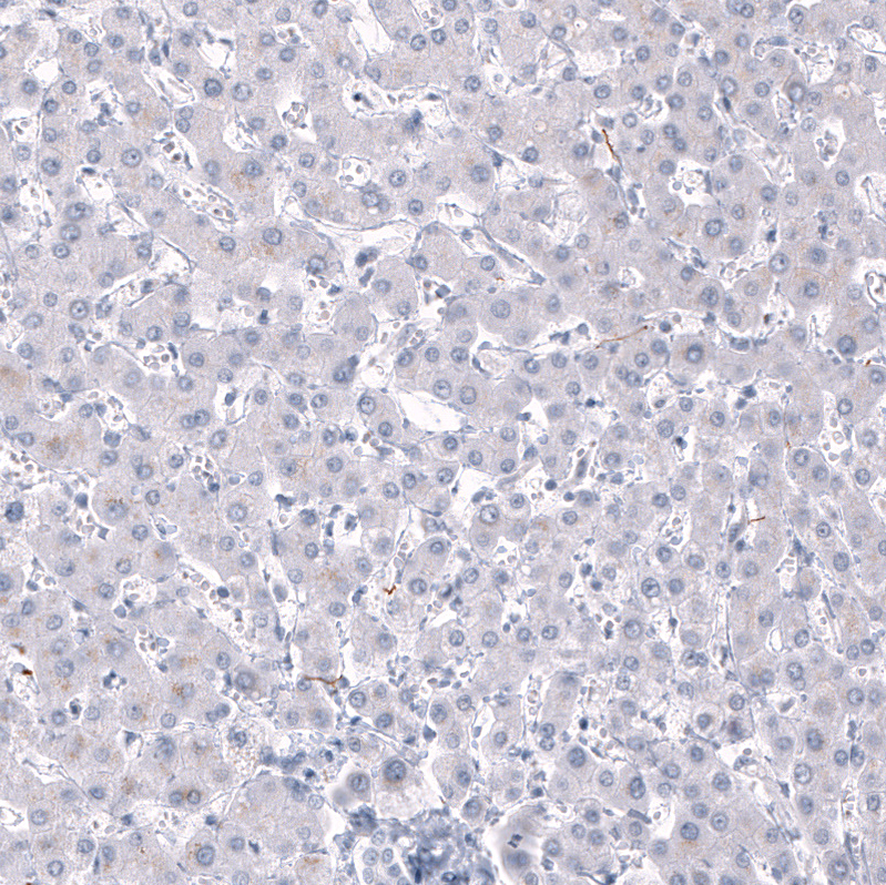 Mouse Monoclonal Anti-CRYAB Antibody - Buy for research - Highly ...
