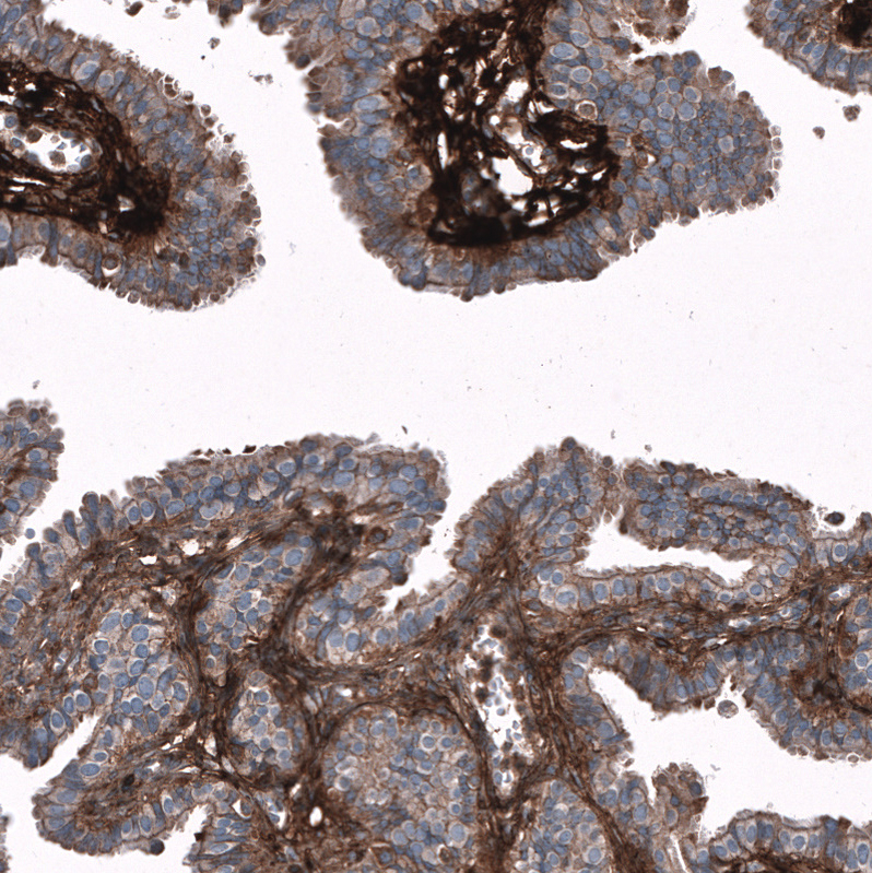 Mouse Monoclonal Anti-POSTN Antibody - Buy for research - Highly ...