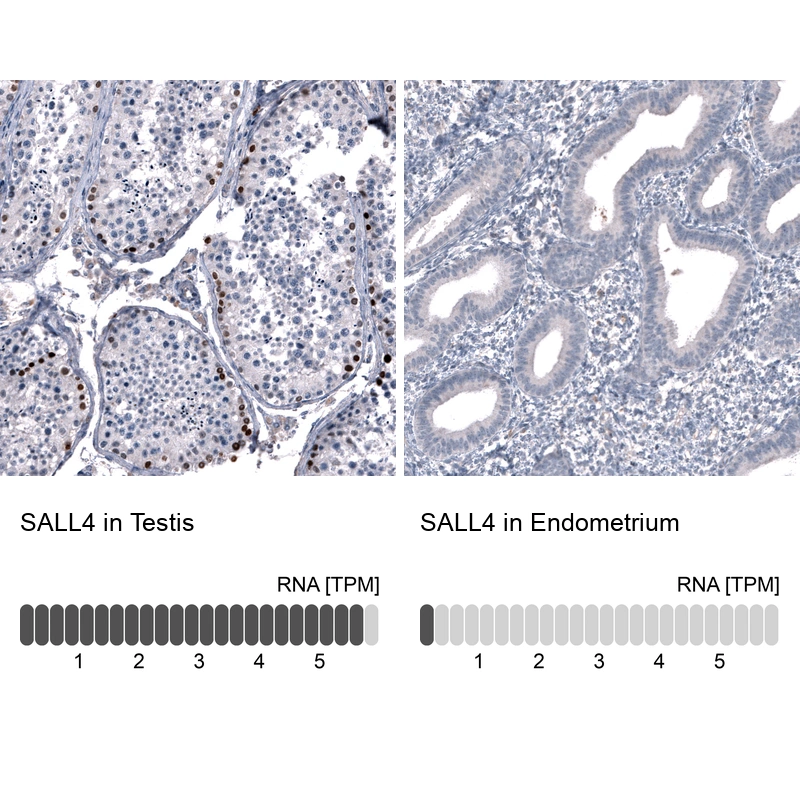 Mouse Monoclonal Anti-SALL4 Antibody - Buy for research - Highly ...