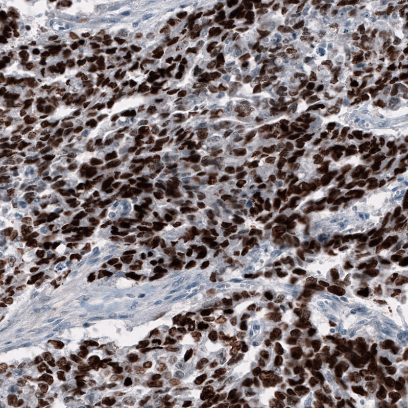Mouse Monoclonal Anti-SALL4 Antibody - Buy for research - Highly ...