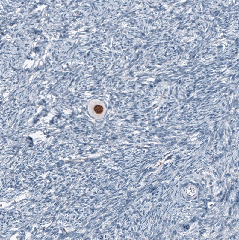 Mouse Monoclonal Anti-SALL4 Antibody - Buy for research - Highly ...