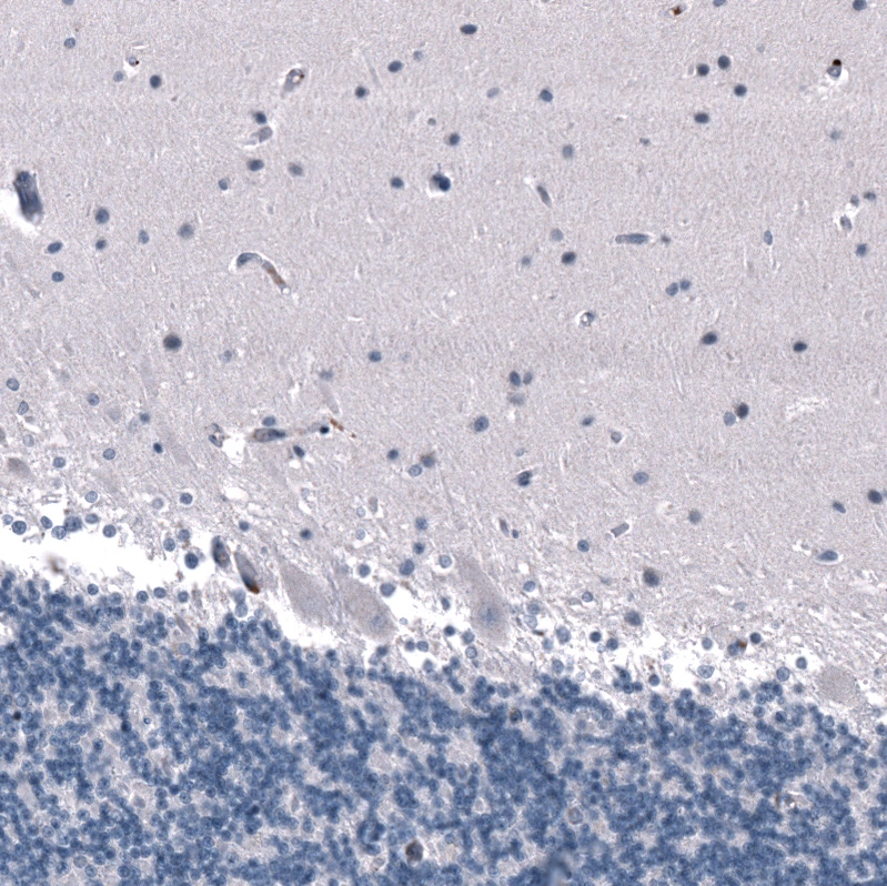 Mouse Monoclonal Anti-SALL4 Antibody - Buy for research - Highly ...
