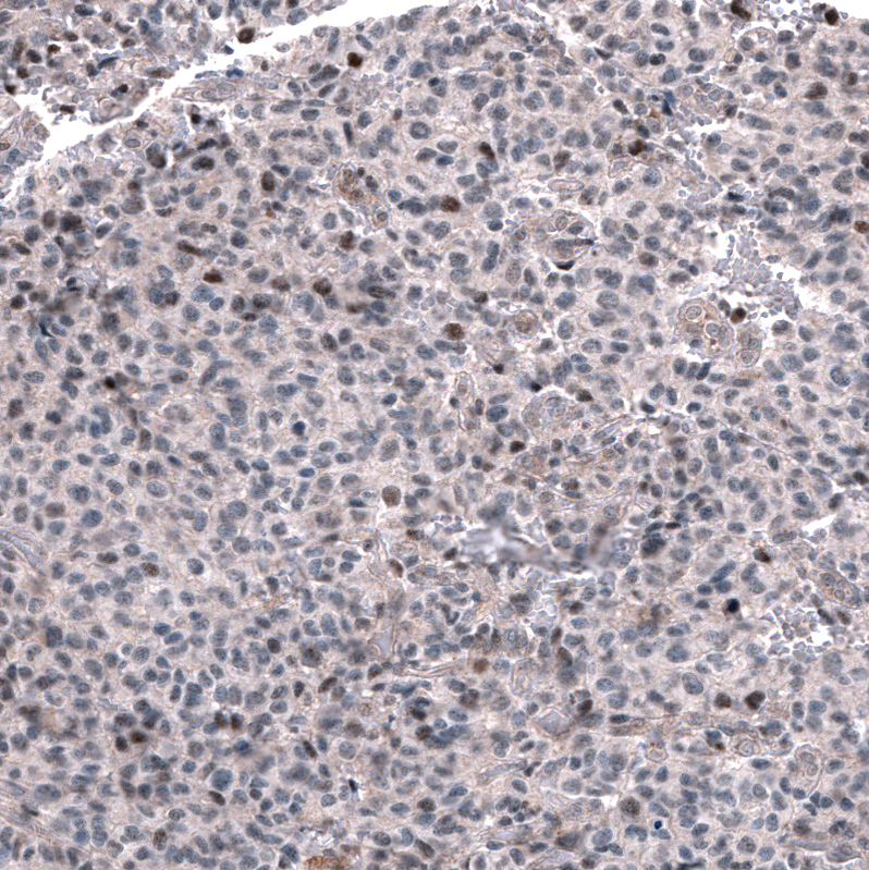 Mouse Monoclonal Anti-GLI1 Antibody - Buy for research - Highly ...