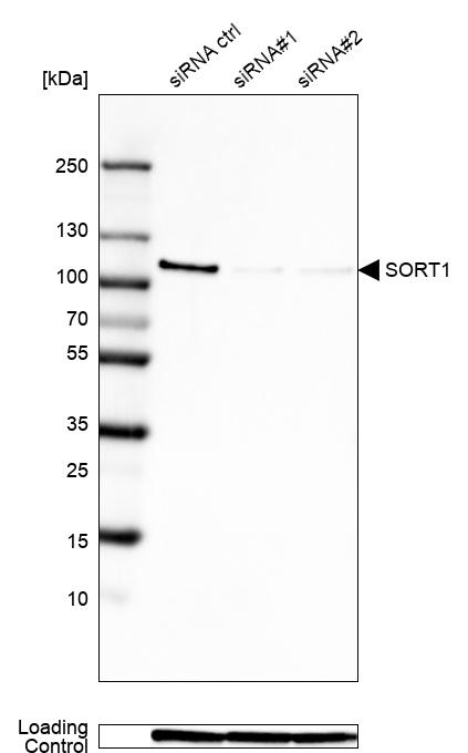Mouse Monoclonal Anti-SORT1 Antibody - Buy for research - Highly ...