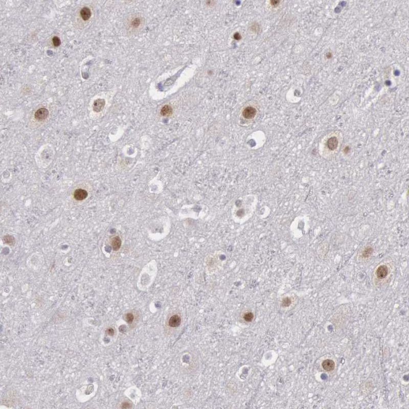 Rabbit Polyclonal Anti-NKAP Antibody - Buy for research - Highly ...