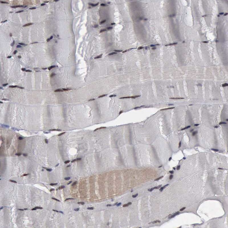 Rabbit Polyclonal Anti-RTCB Antibody - Buy for research - Highly ...