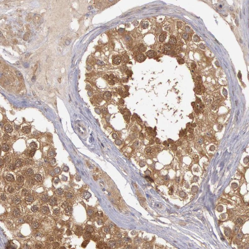 Rabbit Polyclonal Anti-BRAF Antibody - Buy for research - Highly ...