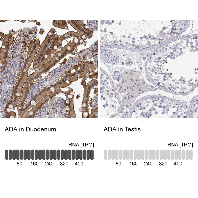 Rabbit Polyclonal Anti-ADA Antibody - Buy for research - Highly ...