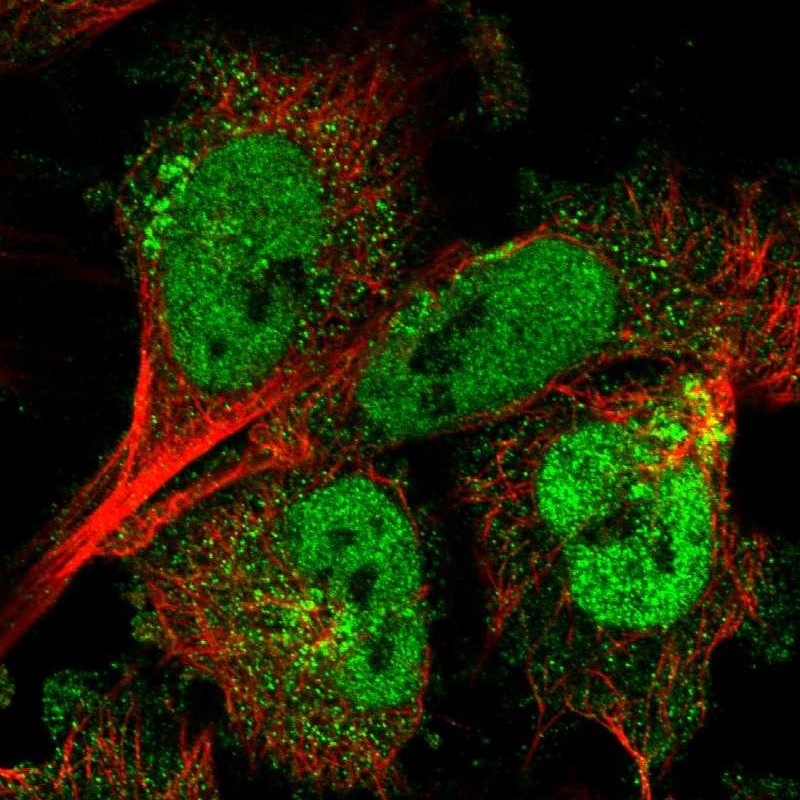 Rabbit Polyclonal Anti-ARMCX3 Antibody - Buy for research - Highly ...