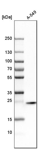 Rabbit Polyclonal Anti-STX8 Antibody - Buy for research - Highly ...