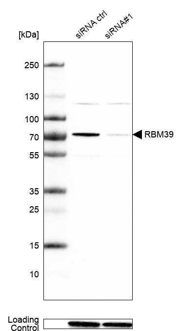 Rabbit Polyclonal Anti-RBM39 Antibody - Buy for research - Highly ...