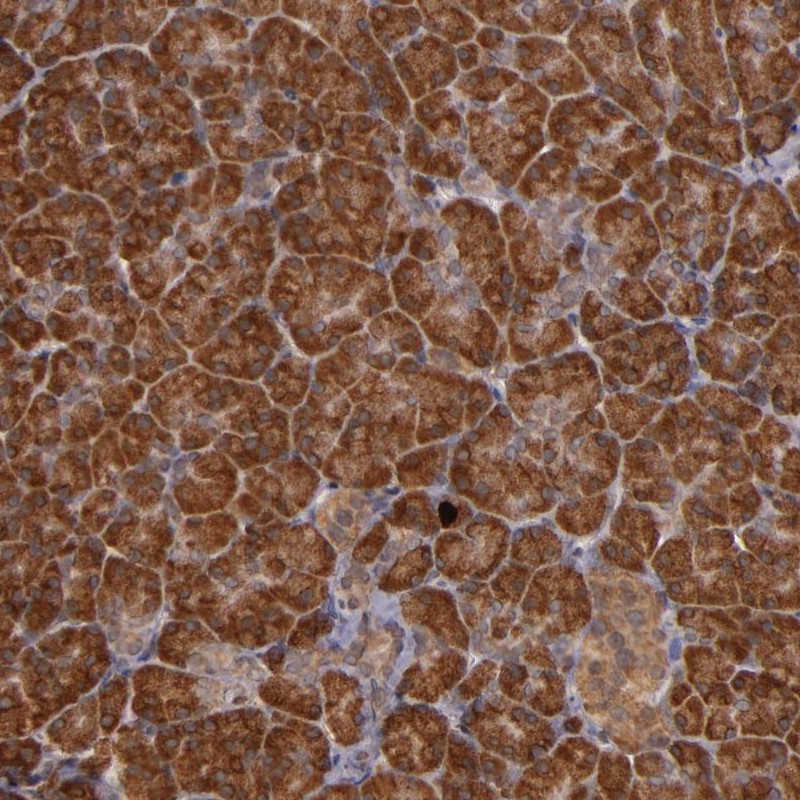Rabbit Polyclonal Anti-RIOK3 Antibody - Buy for research - Highly ...