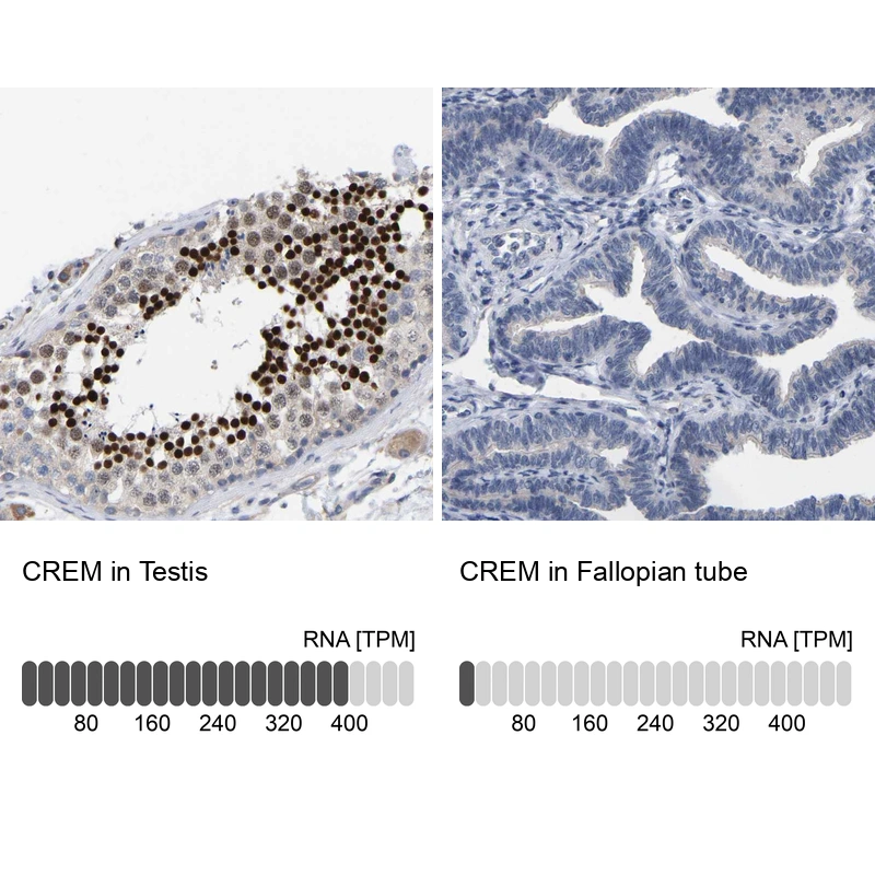 Rabbit Polyclonal Anti-CREM Antibody - Buy for research - Highly ...