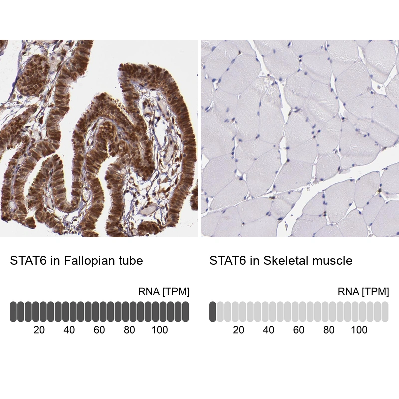 Rabbit Polyclonal Anti-STAT6 Antibody - Buy for research - Highly ...