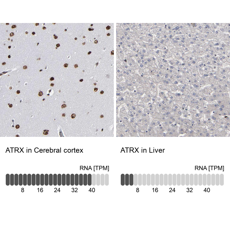 Rabbit Polyclonal Anti-ATRX Antibody - Buy for research - Highly ...