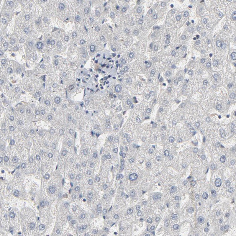 Rabbit Polyclonal Anti-CCT5 Antibody - Buy for research - Highly ...